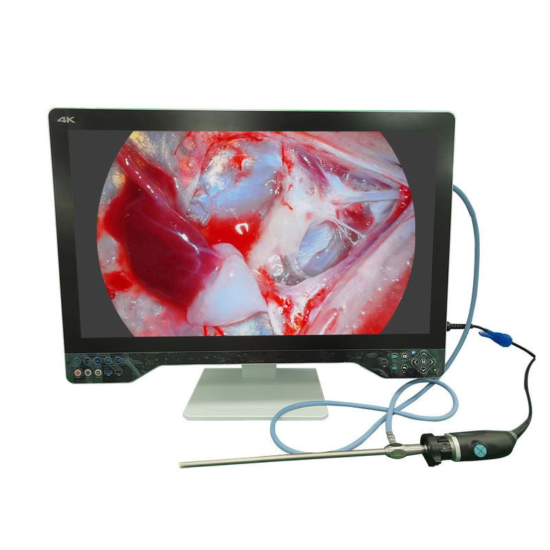 Ultra High Definition Endoscope Camera 4K For Laparoscopy With 32 ...
