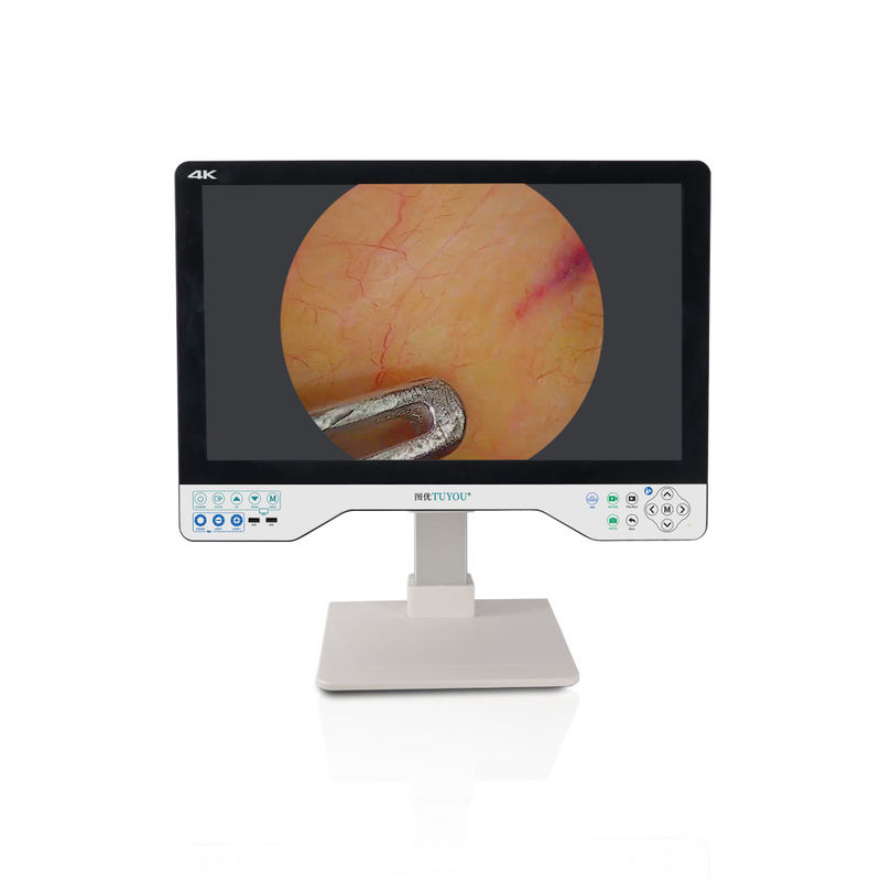 24 Inch Laparoscopic Monitor 4K UHD Endoscope Camera System Surgical ...