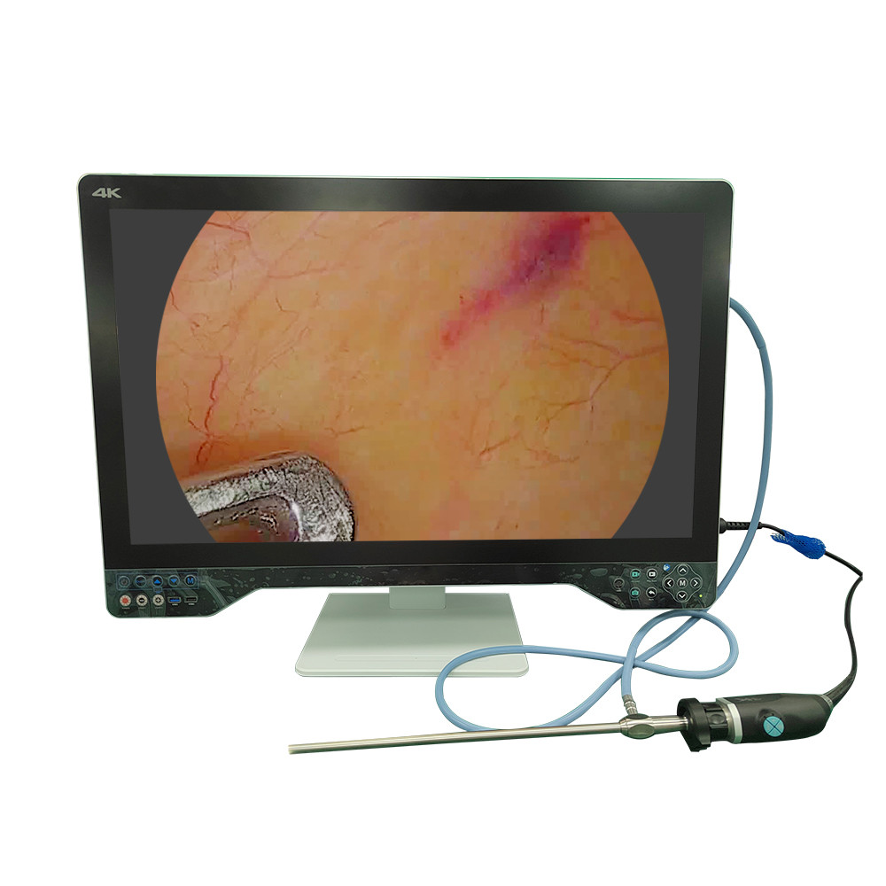 TUYOU 32" 4K Medical ENT Endoscope Camera System Complete with USB ...