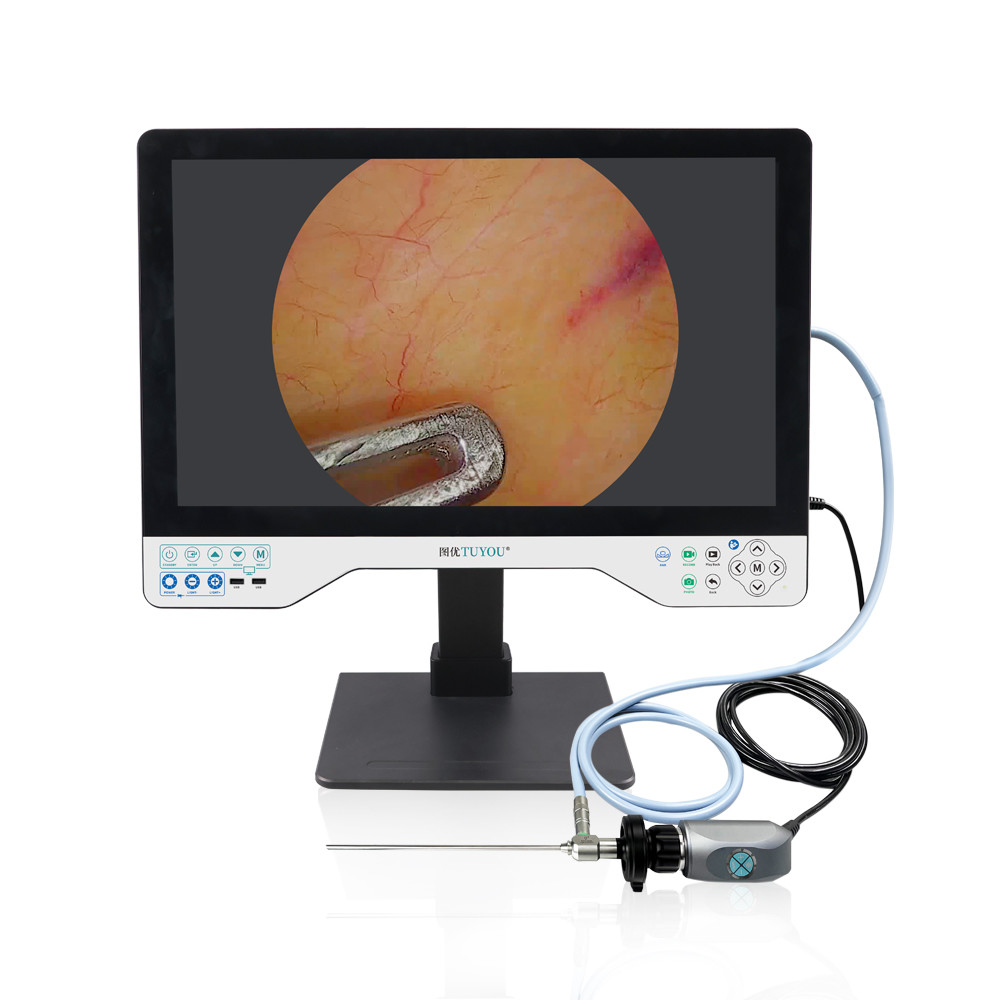 24" Endoscopic Endoscopy LED Light Source HD Endoscope Camera Recorder ...