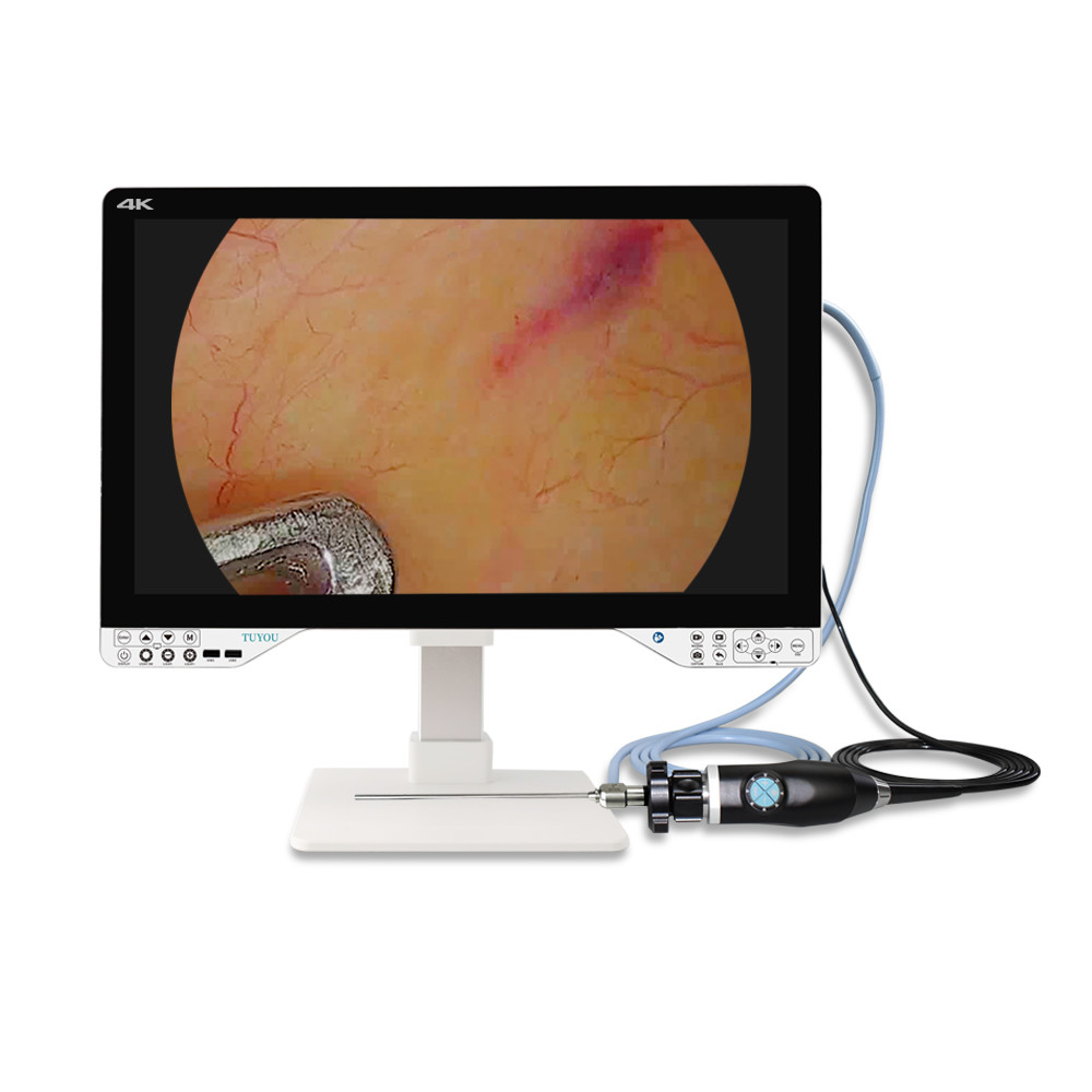 TUYOU 27 Inches Endoscope 4K For Laparoscopic Surgery With Light Source ...