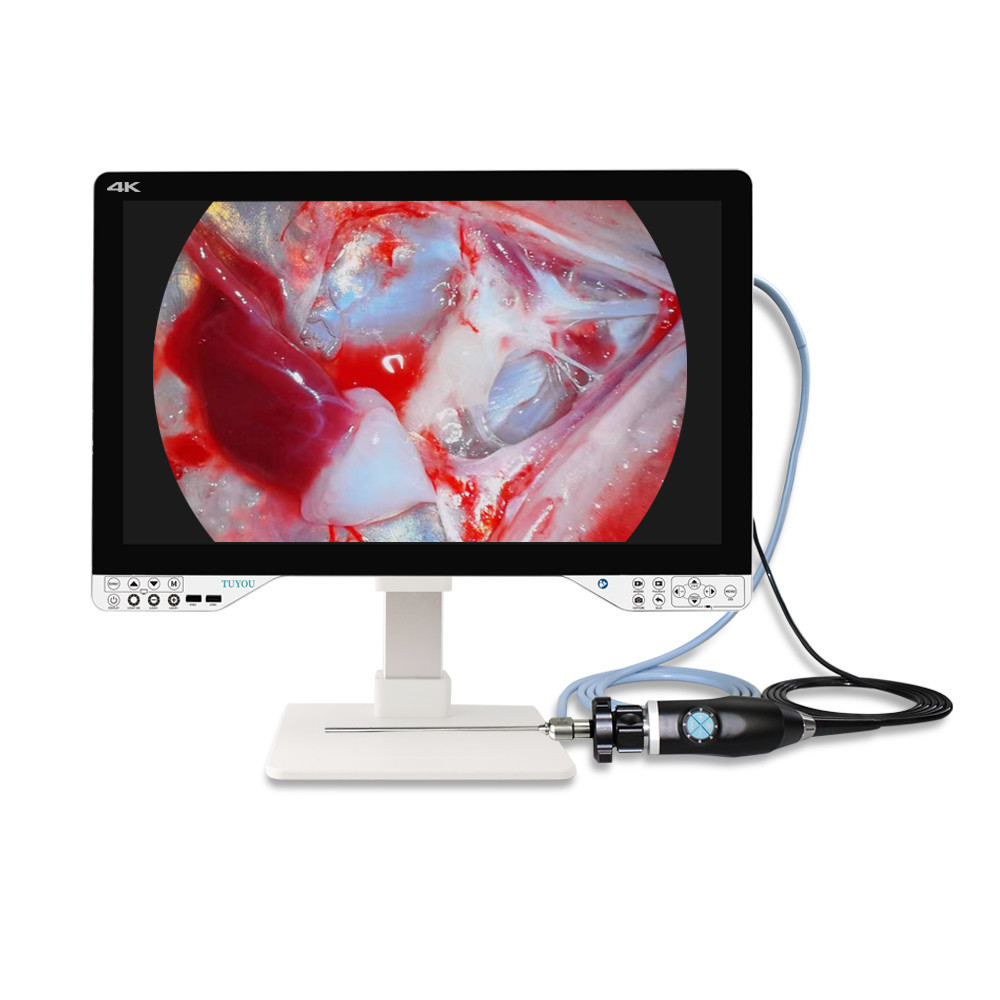 TUYOU Medical 4K All In One Endoscopy Camera System With Light Source ...