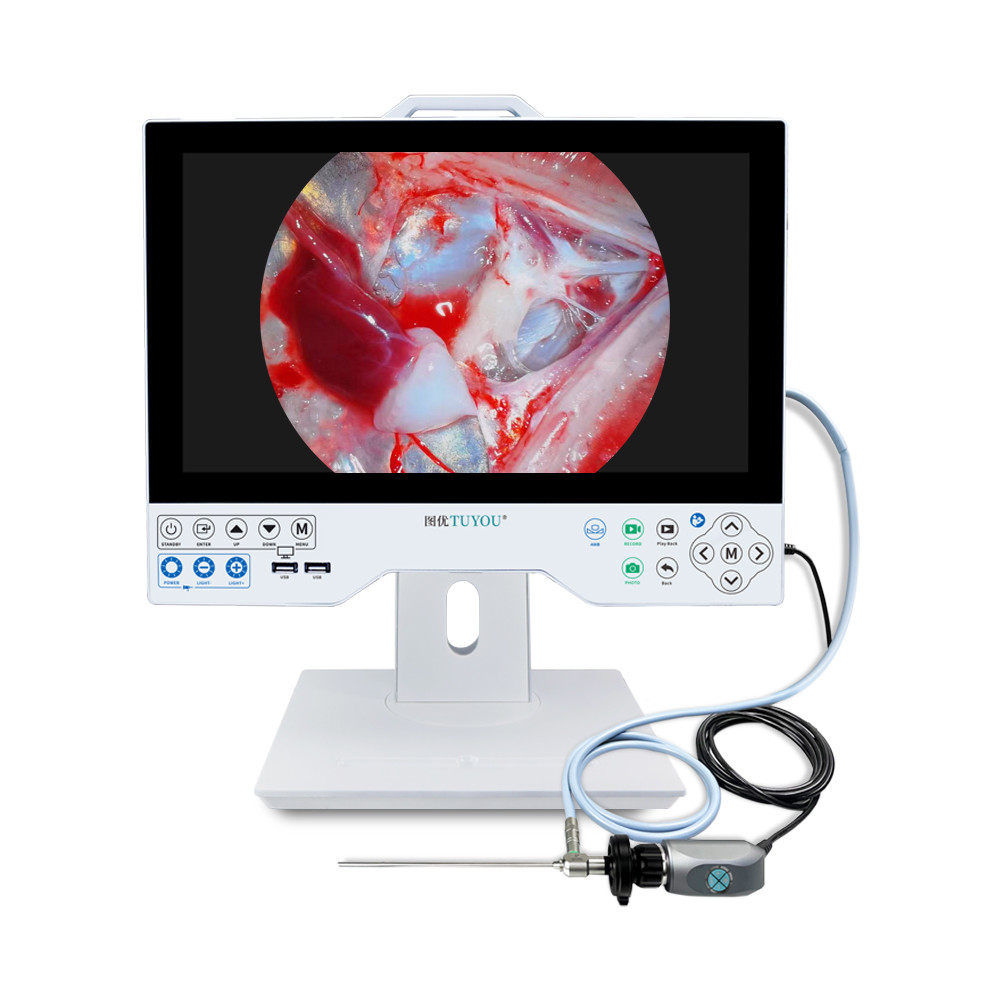 Portable LCD Monitor All in One HD Endoscope Camera for ENT/Laparoscopy ...