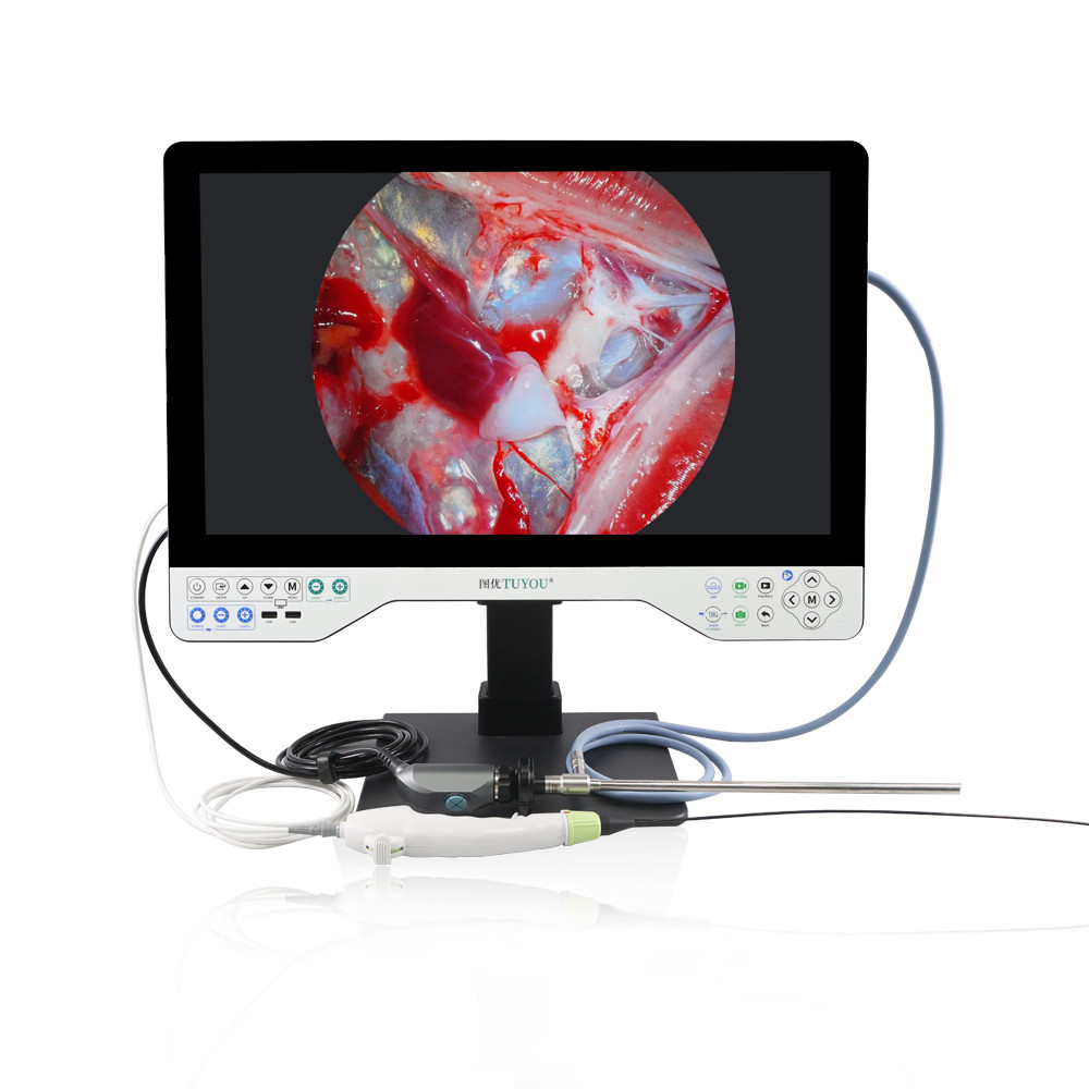 TUYOU Medical 1080P 24'' Rigid and Flexible All in One Endoscope Camera ...