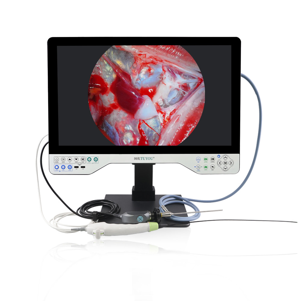 15-inch Monitor Mode Selection TUYOU All-in-One Medical Endoscope ...