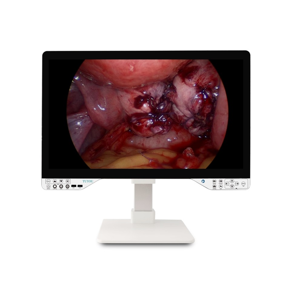 27 Inch FHD 1080P Endoscopic Camera System Only Rigid Endoscope with ...