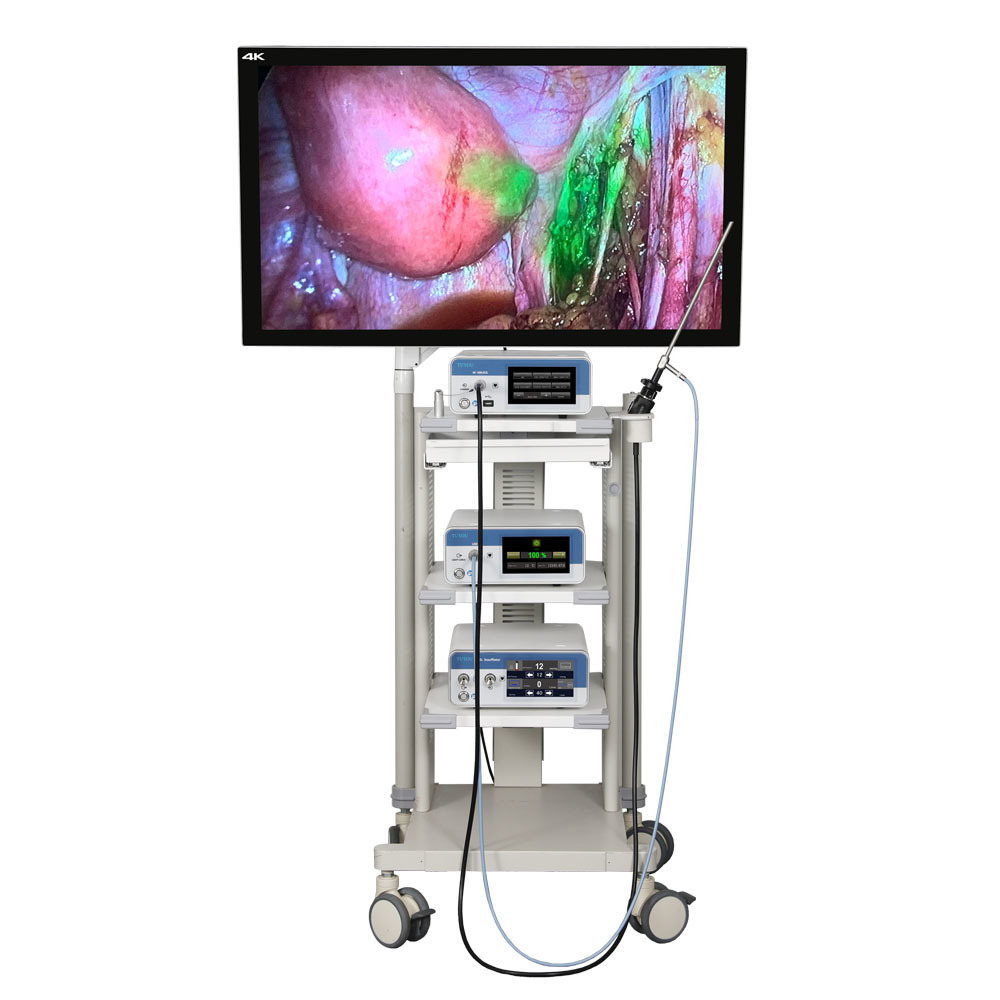 TUYOU 4K ICG Endoscopic Camera System with Recorder – Factory Direct ...